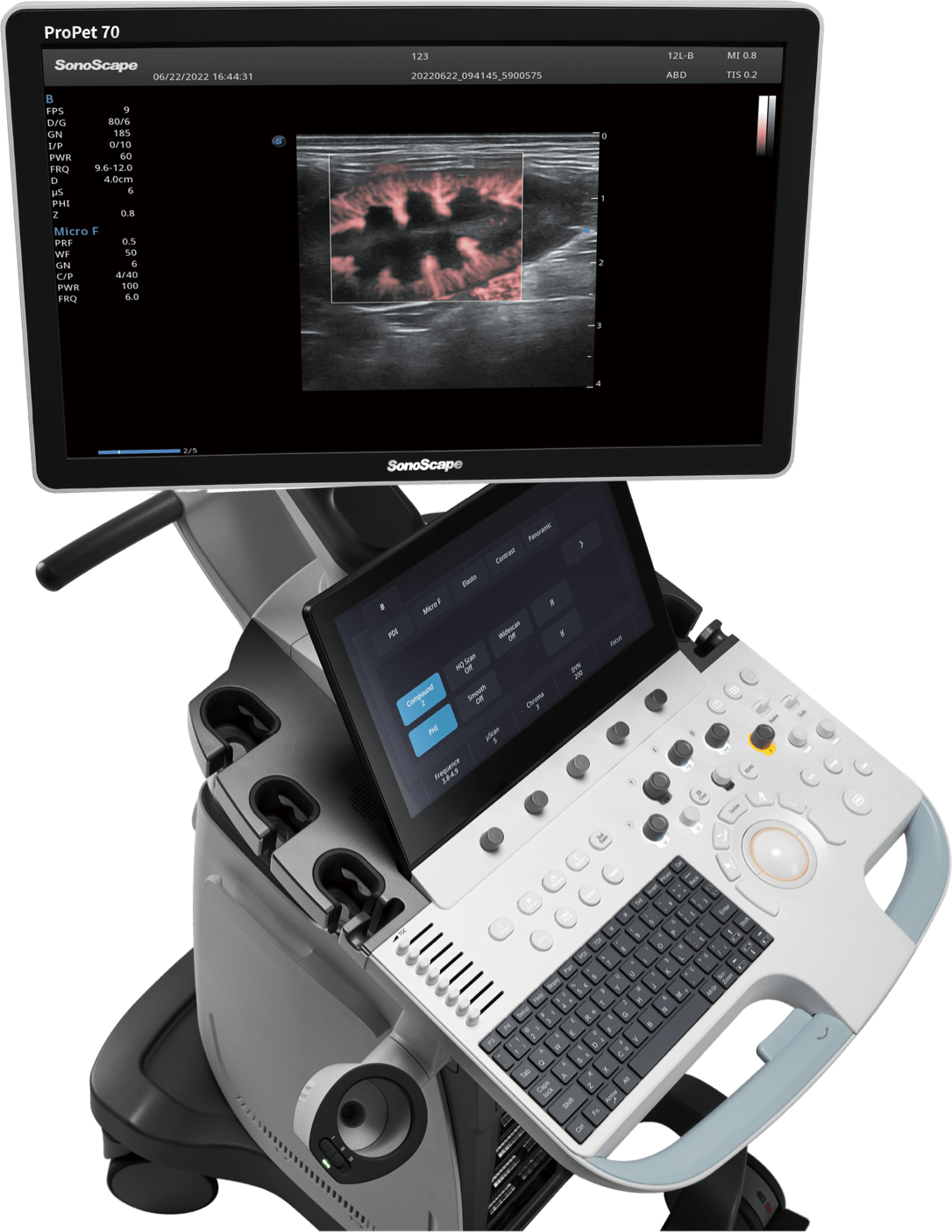 ProPet 70 - Cart-based Color Doppler - SonoScape