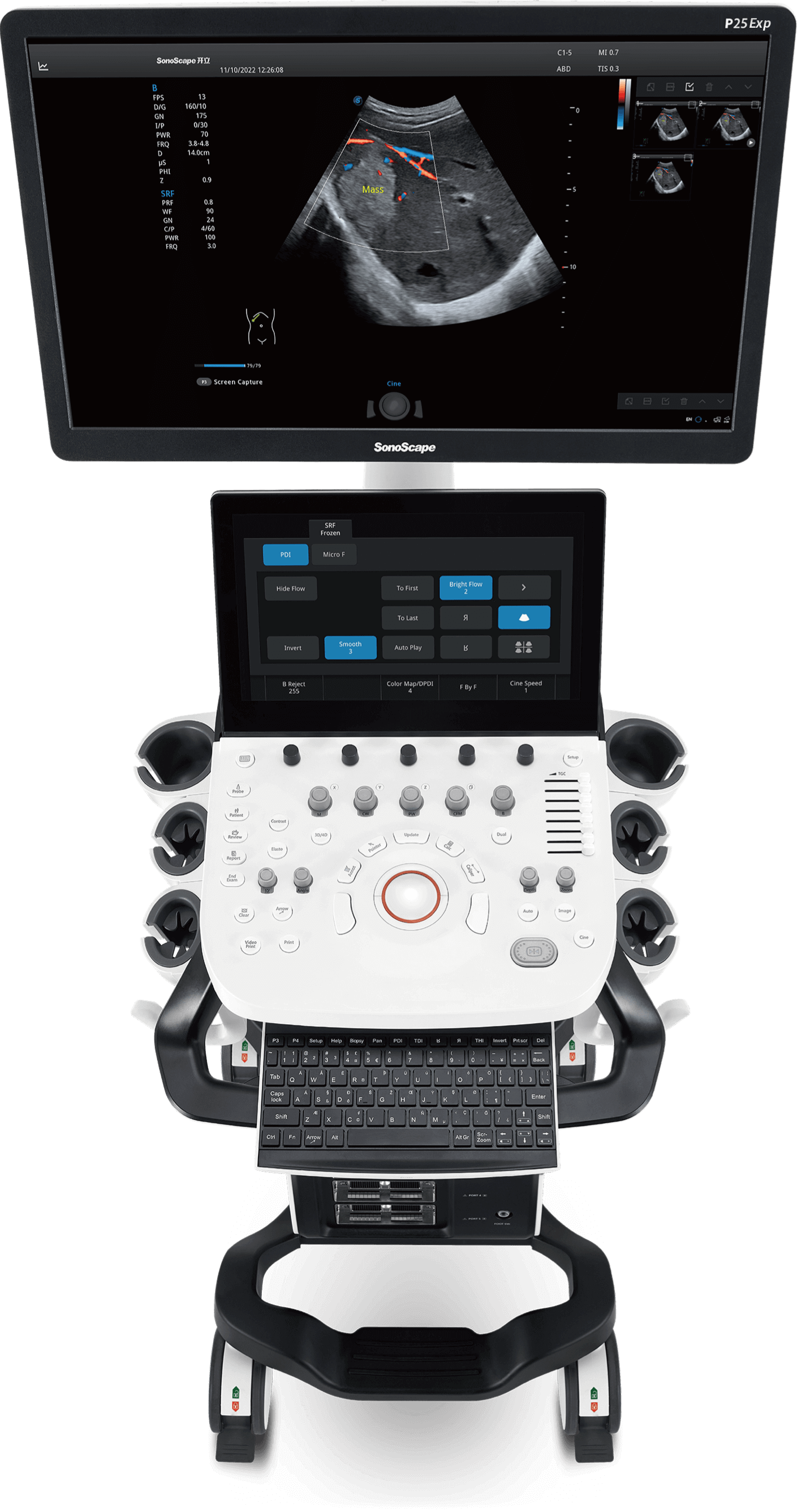 P25 Exp - Trolley Color Doppler - SonoScape