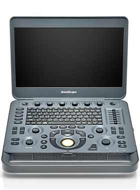 Ultrasound - SonoScape